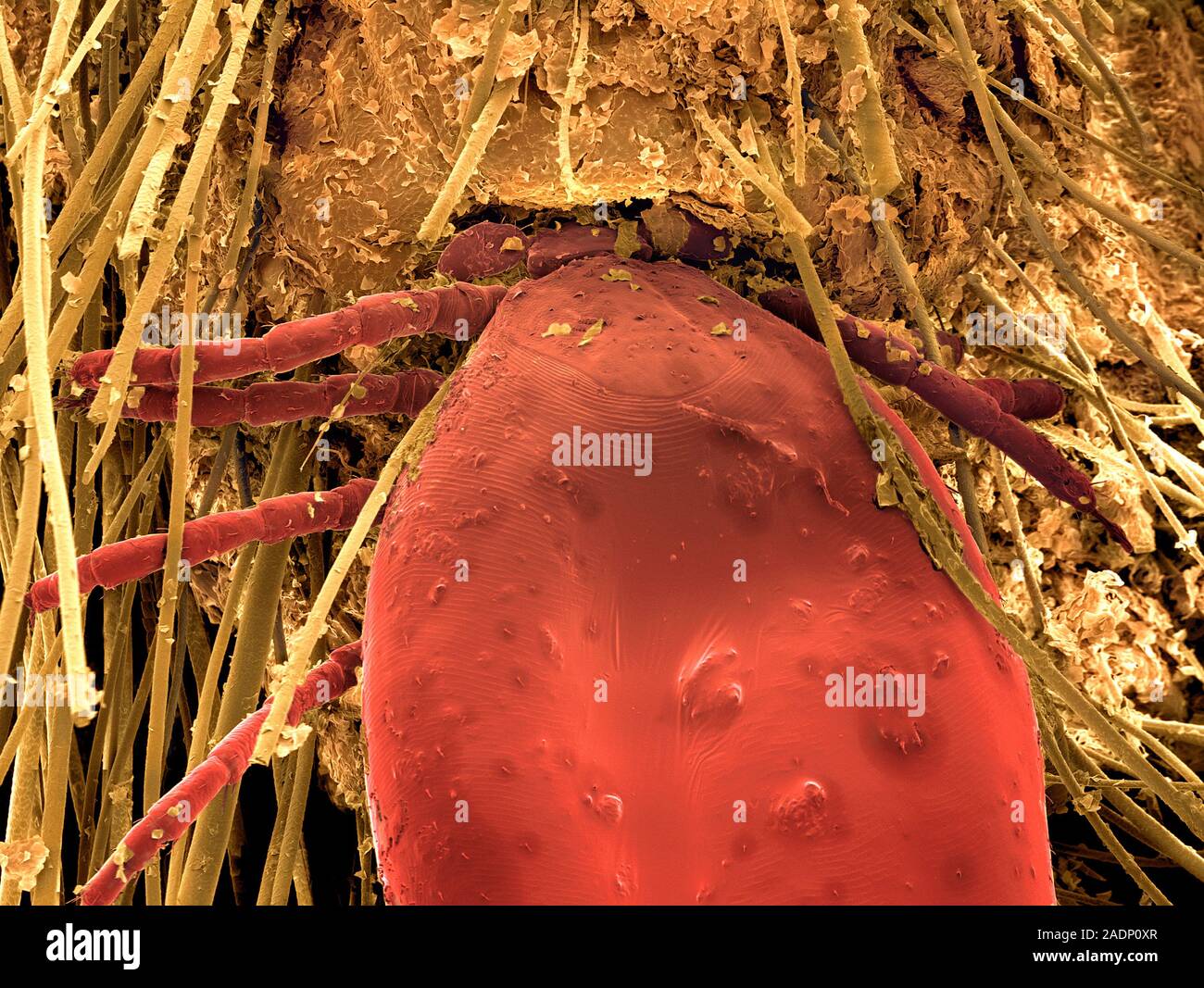 Hedgehog tick. Coloured scanning electron micrograph (SEM) of a ...