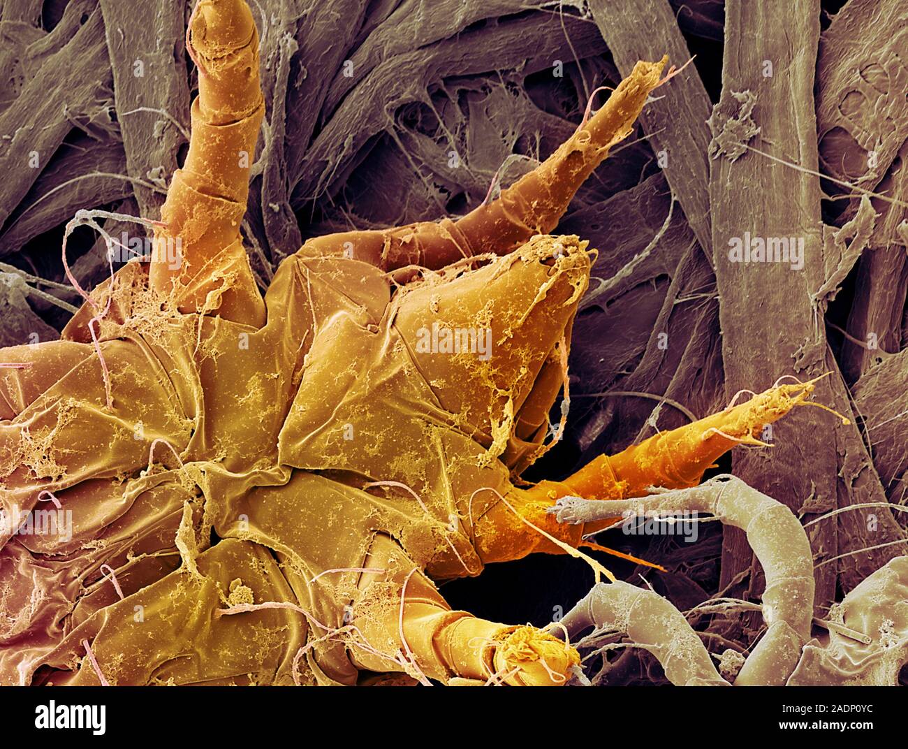Dust mite. Coloured scanning electron micrograph (SEM) of the underside ...