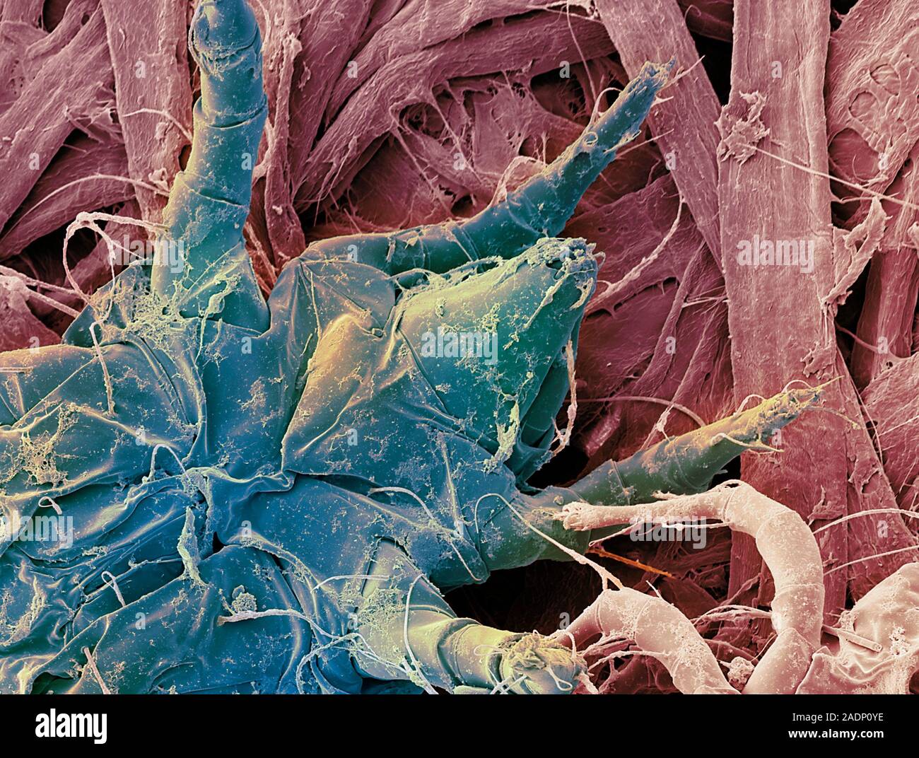 Dust mite. Coloured scanning electron micrograph (SEM) of the underside ...