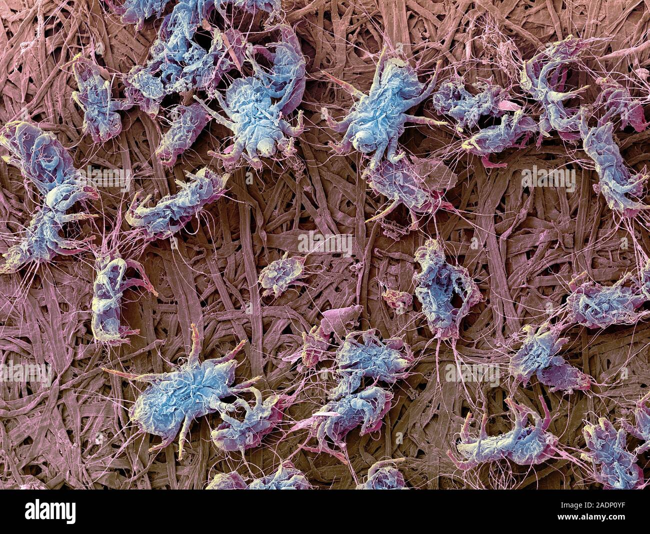 Dust mites. Coloured scanning electron micrograph (SEM) of several ...