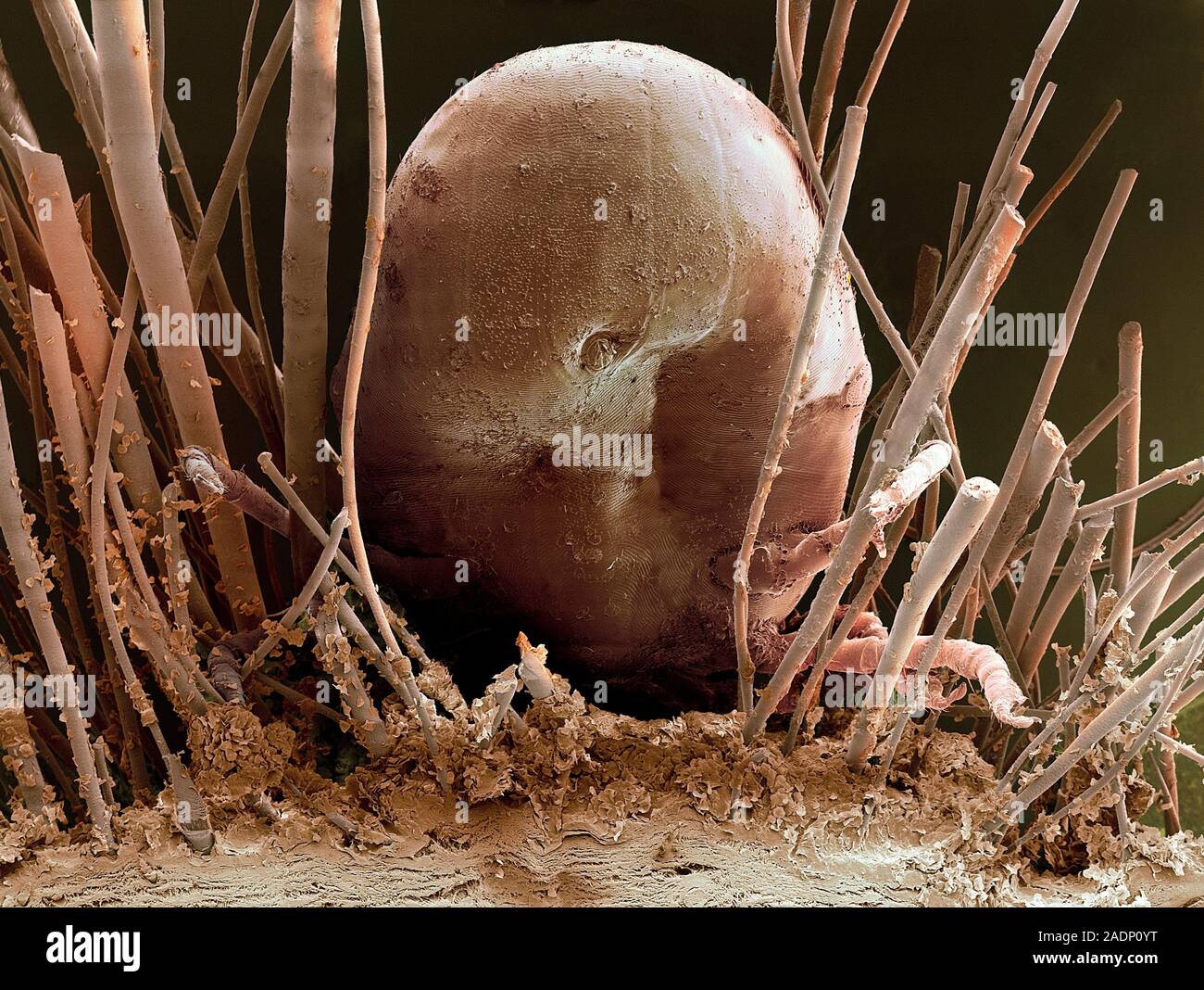 Hedgehog tick. Coloured scanning electron micrograph (SEM) of a ...