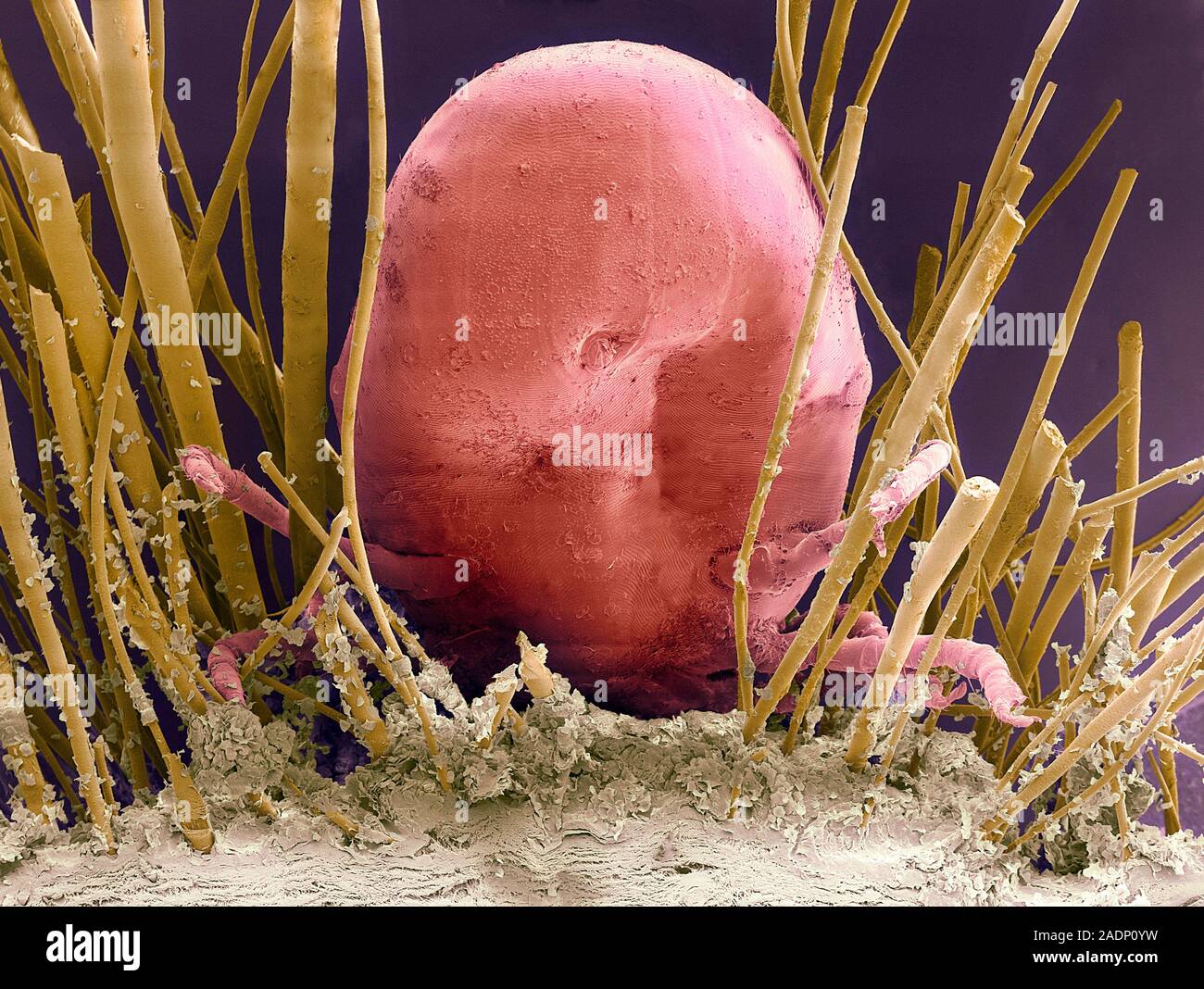Hedgehog tick. Coloured scanning electron micrograph (SEM) of a ...