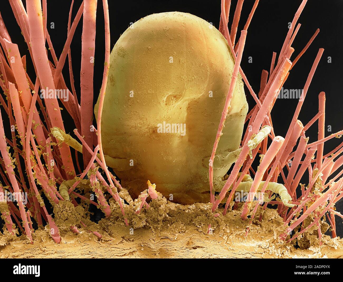 Hedgehog tick. Coloured scanning electron micrograph (SEM) of a ... Hedgehog tick. Coloured scanning electron micrograph (SEM) of a ...