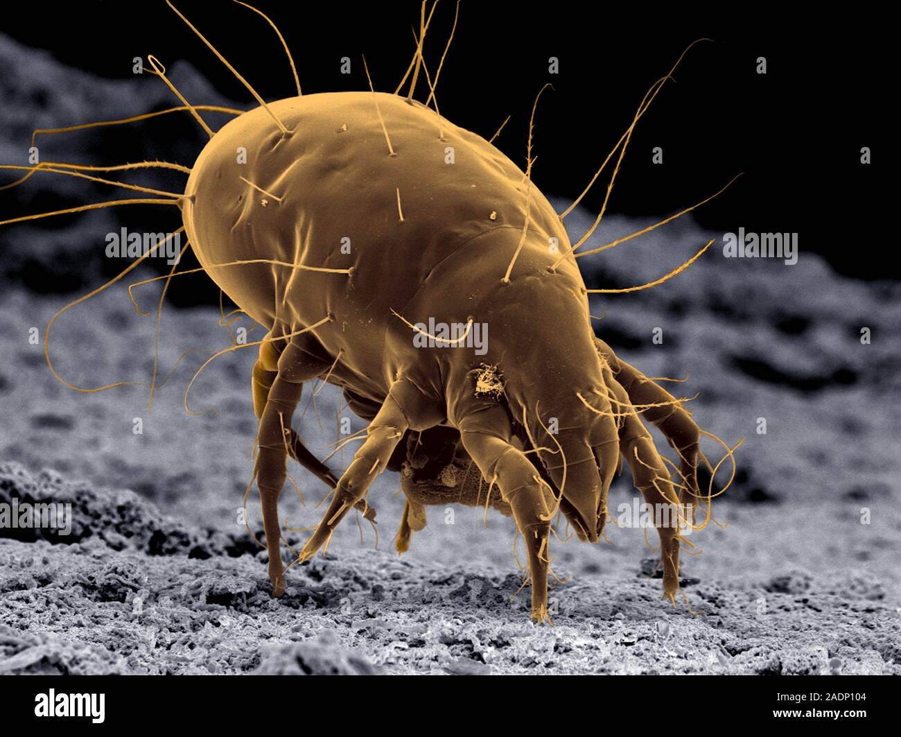 Cheese mite. Coloured scanning electron micrograph (SEM) of a cheese ...