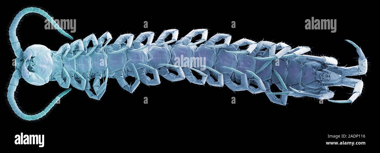 Centipede. Coloured scanning electron micrograph (SEM) of the underside ...
