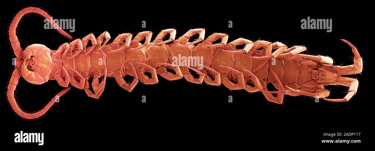 Centipede. Coloured scanning electron micrograph (SEM) of the underside ...