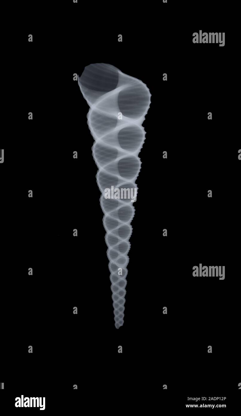 Seashell. X-ray of the shell of an unidentified marine gastropod Stock ...