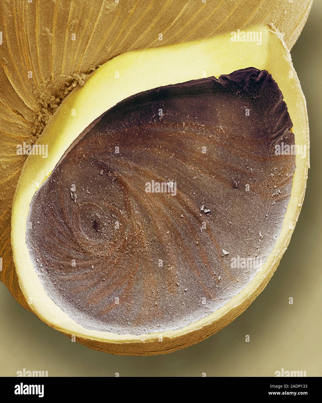 Snail opening. Coloured scanning electron micrograph (SEM) of the ...