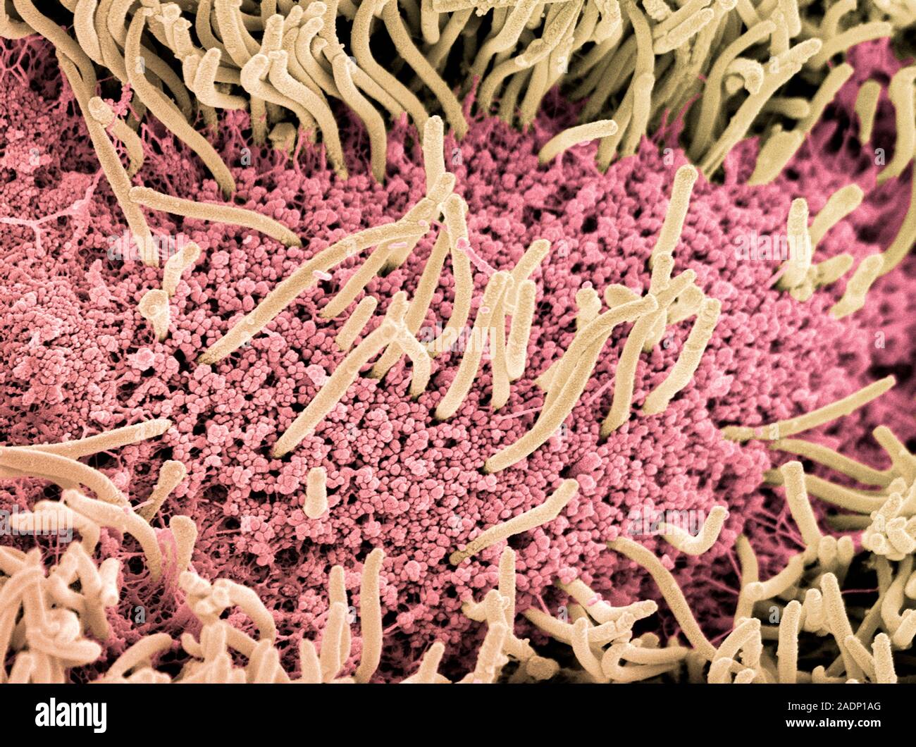 Slug. Coloured scanning electron micrograph (SEM) of the underside of a ...