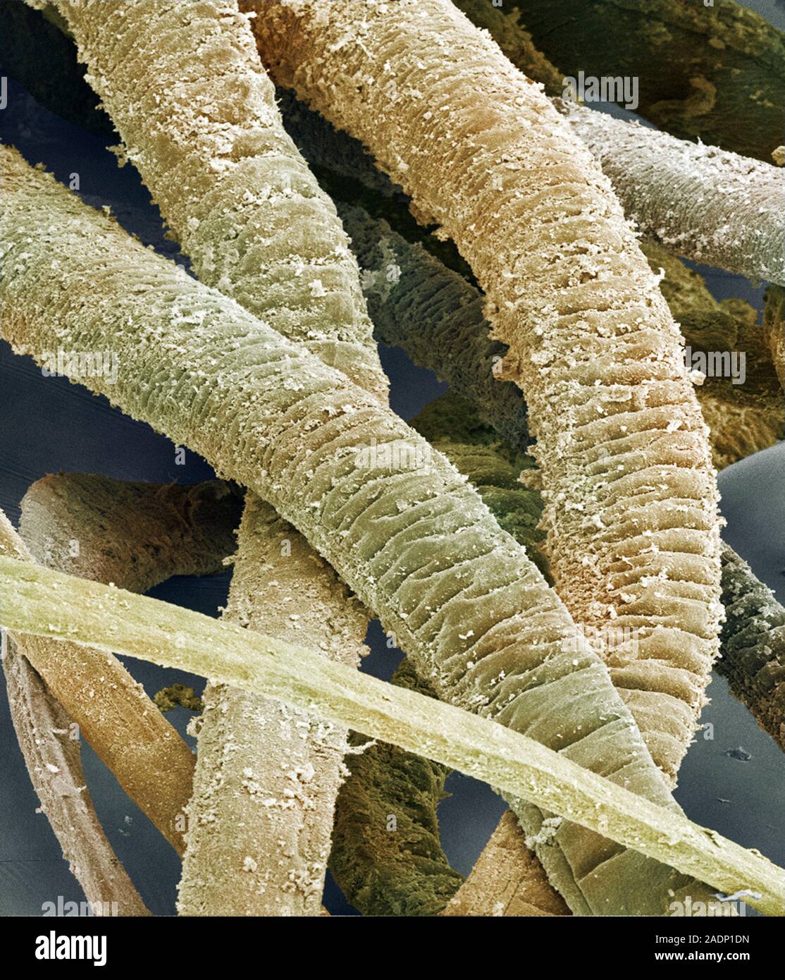 Mussel glue. Coloured scanning electron micrograph (SEM) of the byssus ...