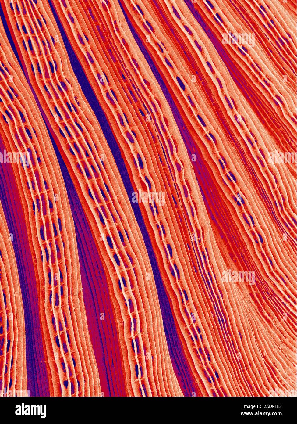 Clam's gill, coloured scanning electron micrograph (SEM). The gill is ...