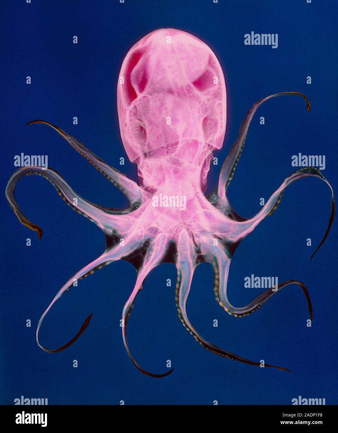 Octopus. Coloured X-ray of an unidentified octopus. Octopuses are ...