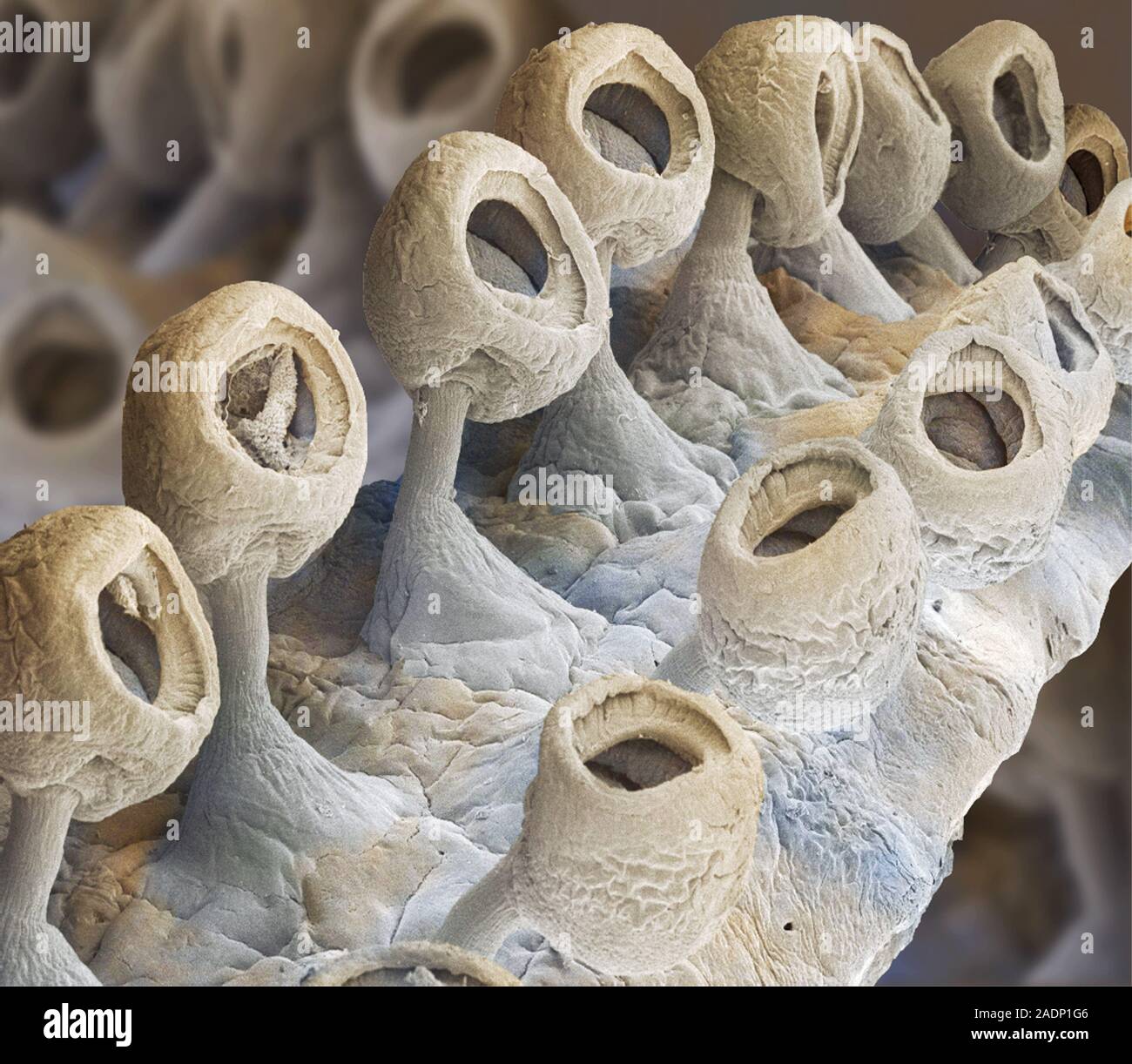Squid suckers. Coloured scanning electron micrograph (SEM) of suckers ...