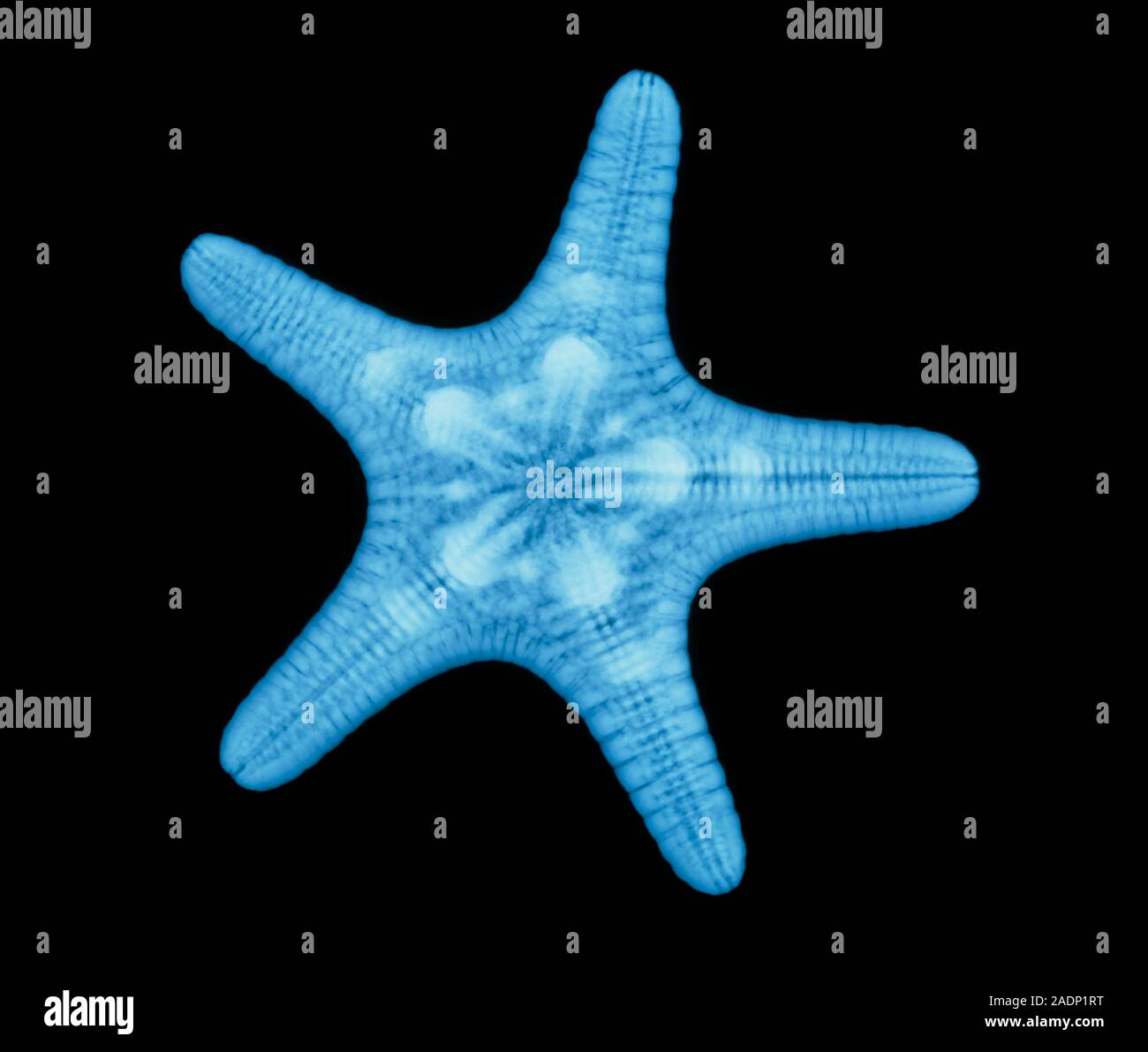 Starfish. X-ray of a starfish (phylum: Echino-dermata), seen in ventral ...