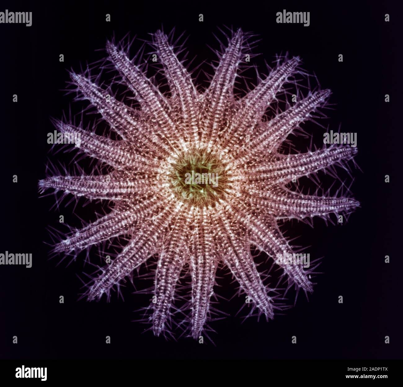 Crown-of-thorns starfish skeleton. Coloured X-ray of the crown-of ...