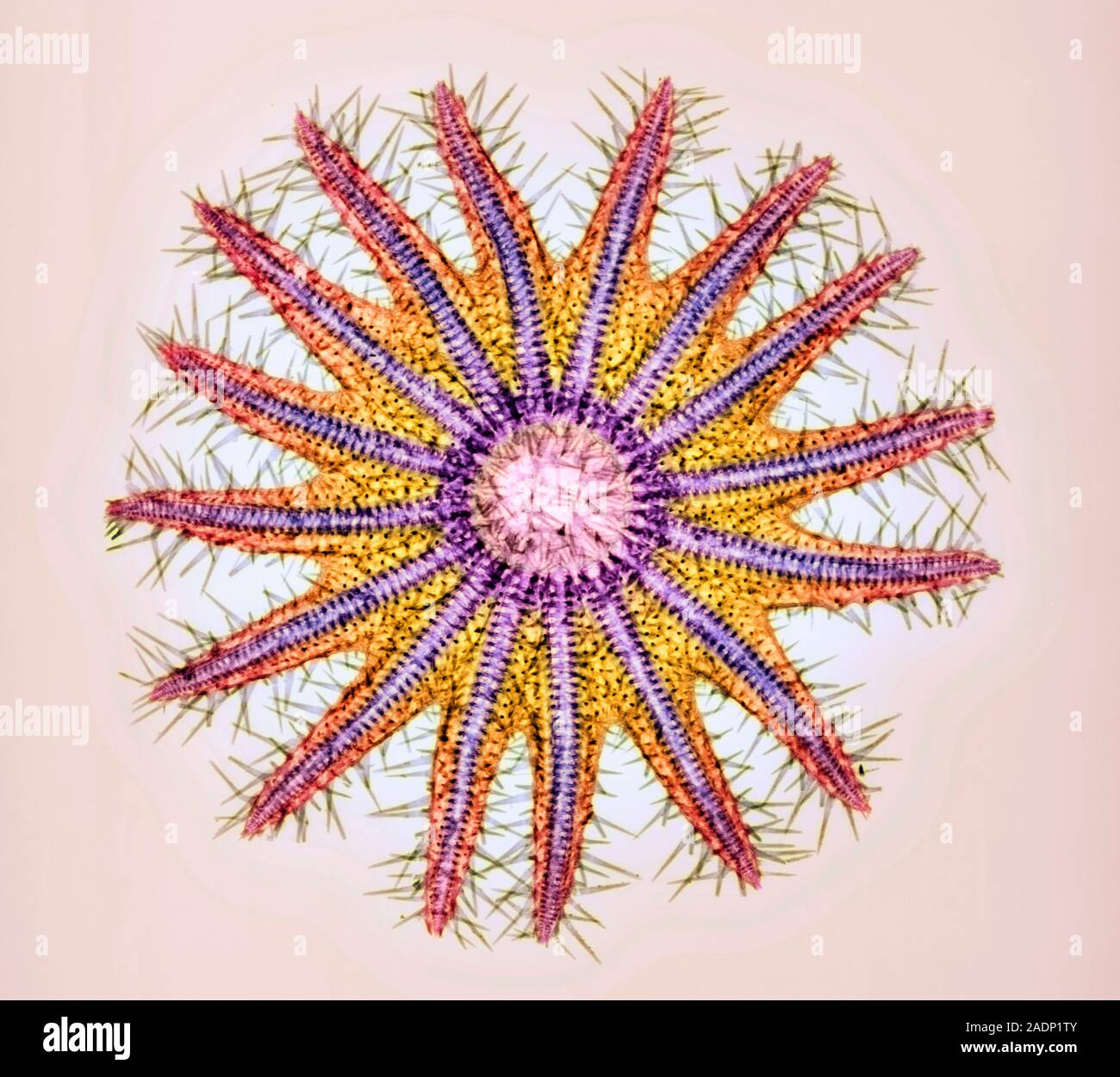 Crown-of-thorns starfish skeleton. Coloured X-ray of the crown-of ...