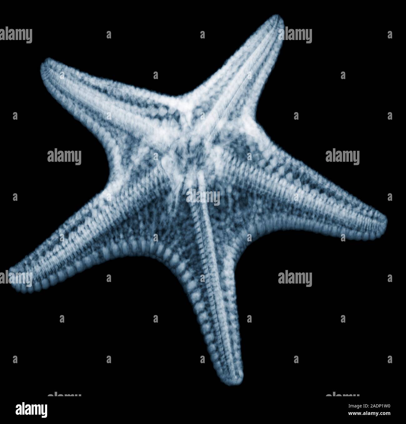 Starfish (class Asteroidea). X-ray of a starfish, a marine animal with ...