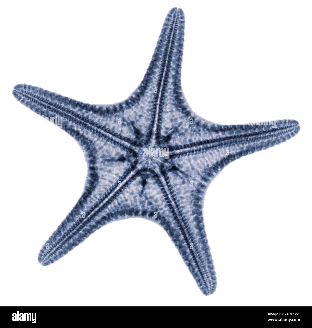 Starfish (class Asteroidea). X-ray of a starfish, a marine animal with ...
