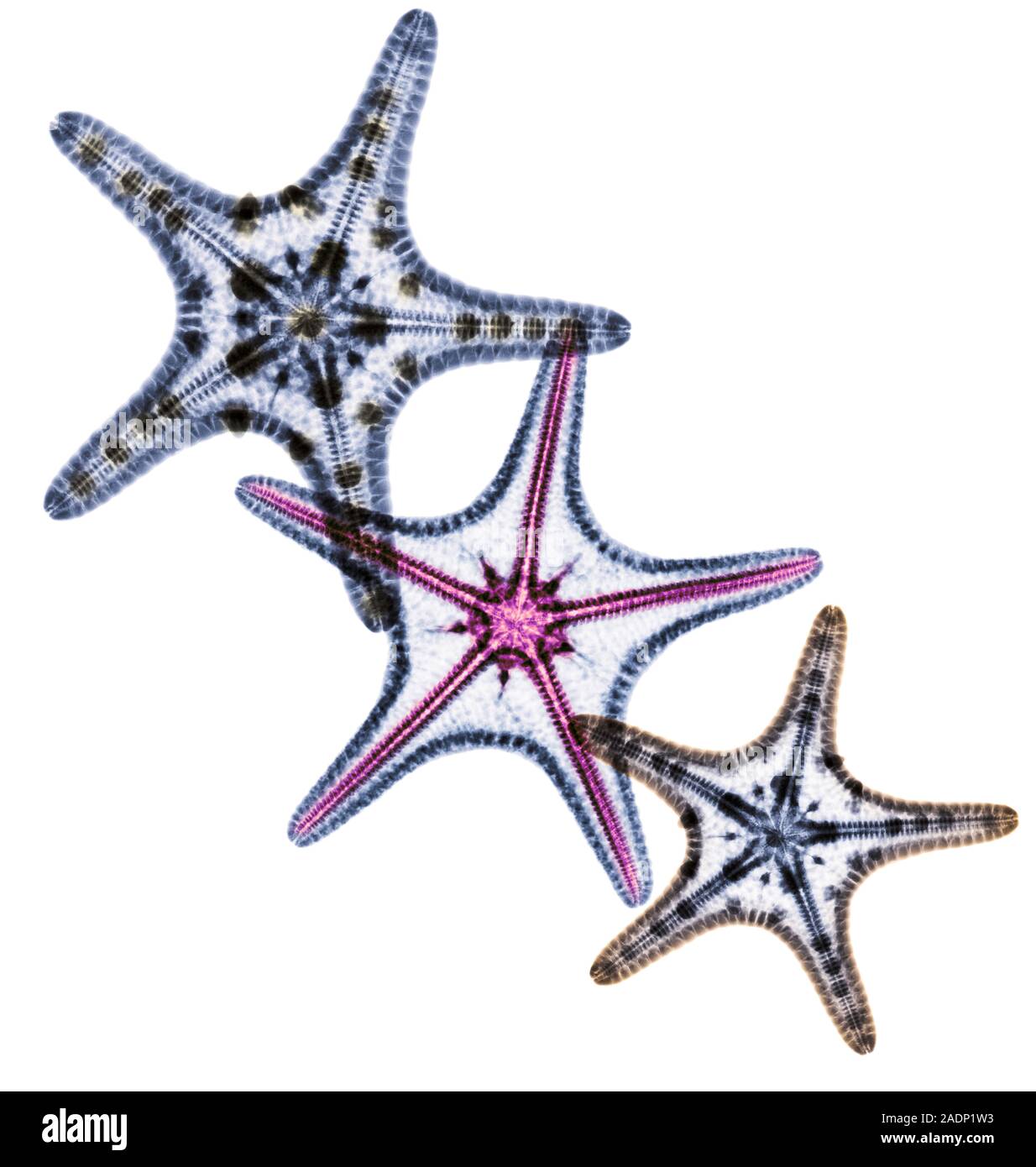 Starfish (class Asteroidea). Coloured X-ray of three starfish, a marine ...