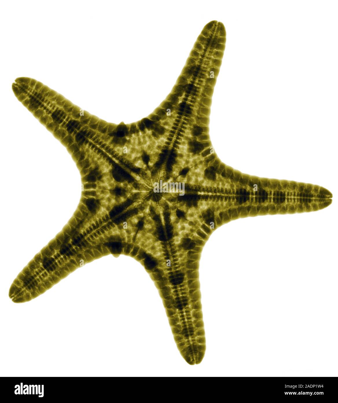 Starfish (class Asteroidea). Coloured X-ray of a starfish, a marine ...