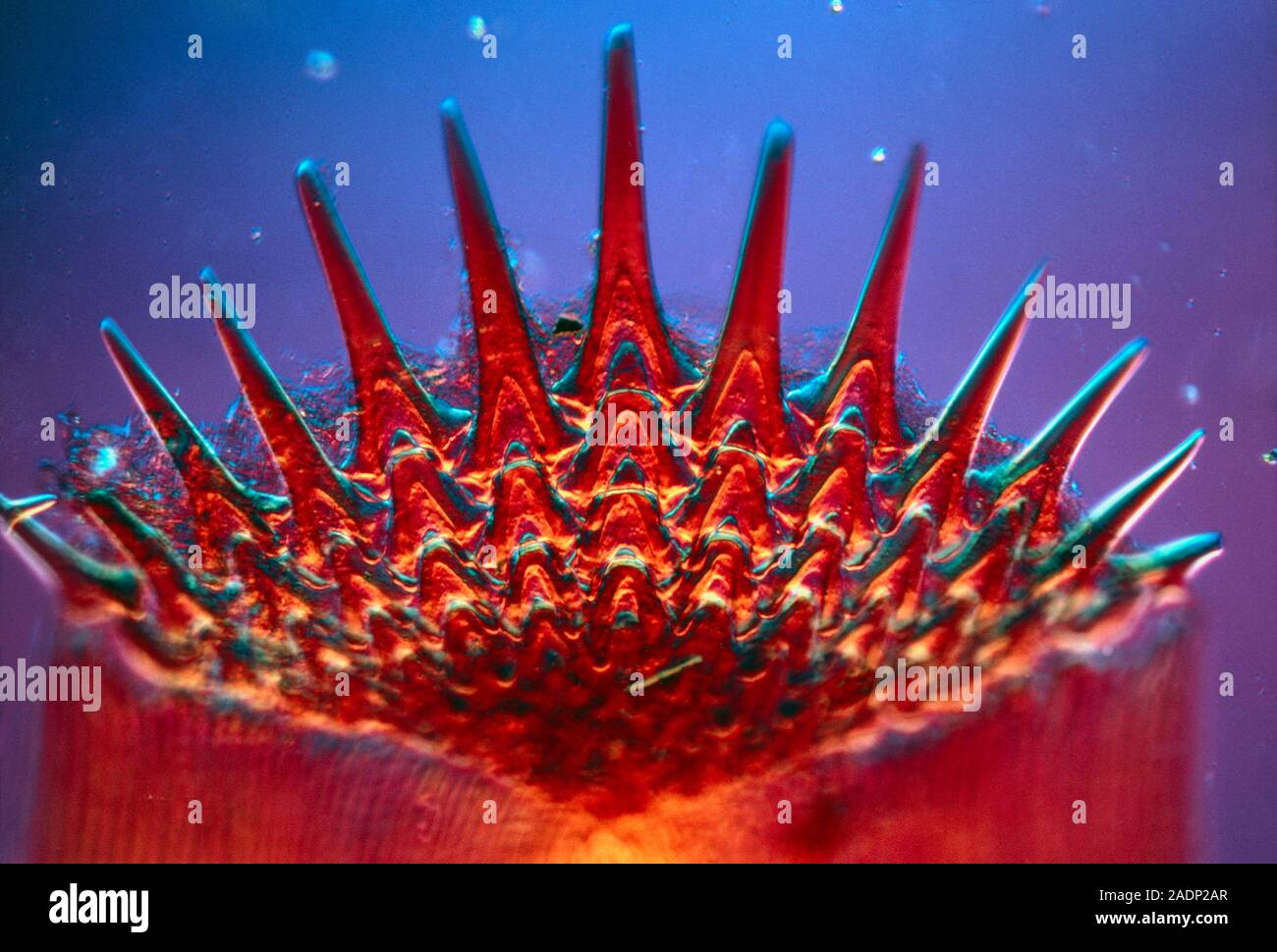 Light micrograph of the toothed edge of the scale of a sole, a bony ...