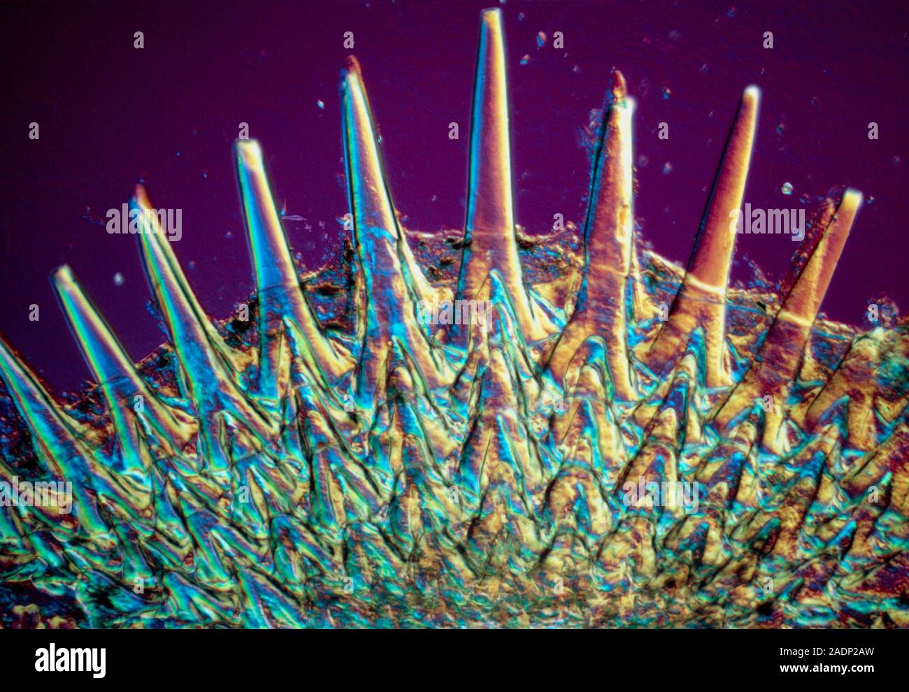 Light micrograph of the toothed edge of the scale of a sole, a bony ...