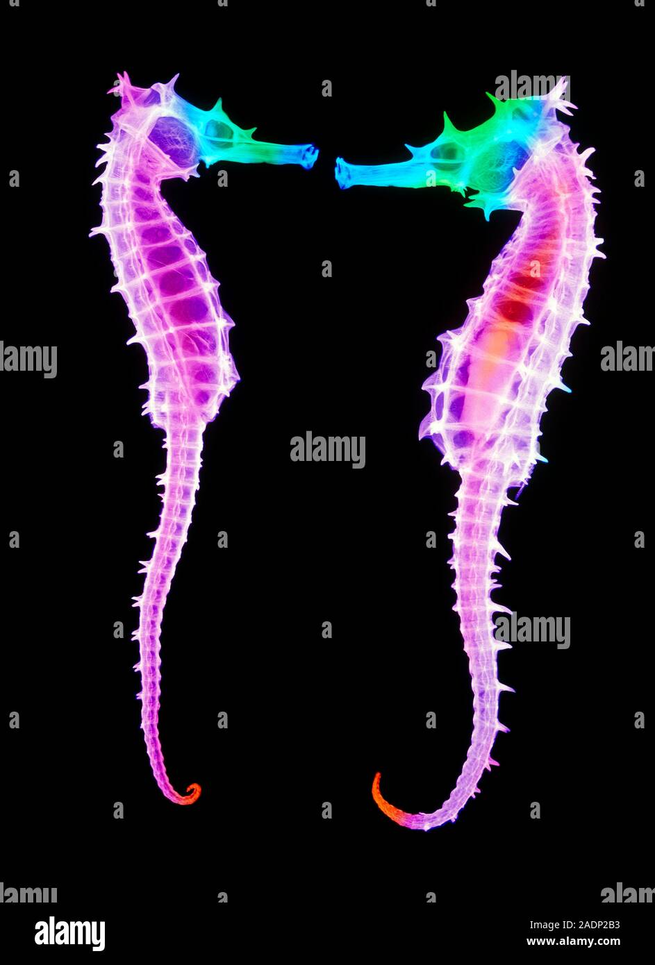False-colour X-ray of two seahorses, Hippocampus sp., facing each other ...