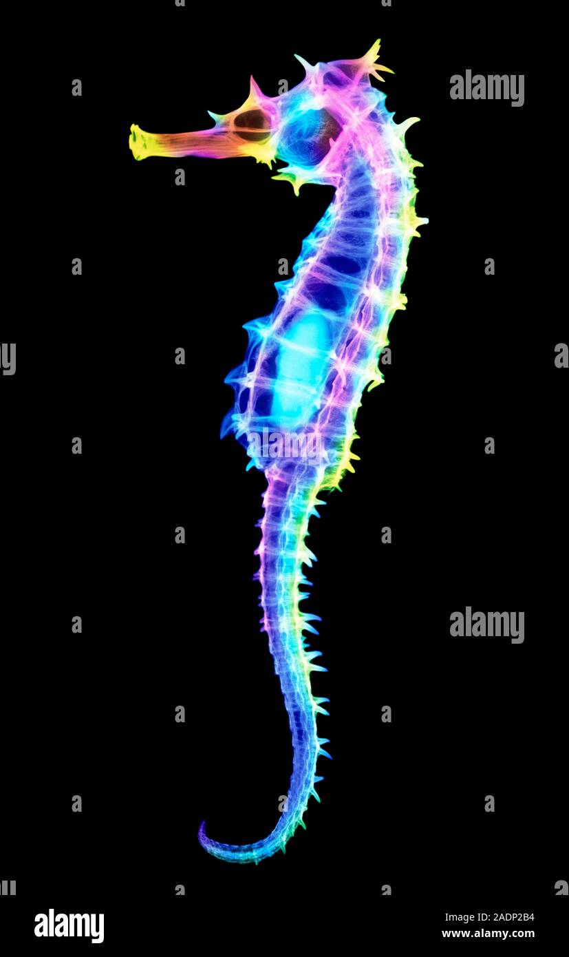 False-colour X-ray of a seahorse, Hippocampus sp., in side view. The ...