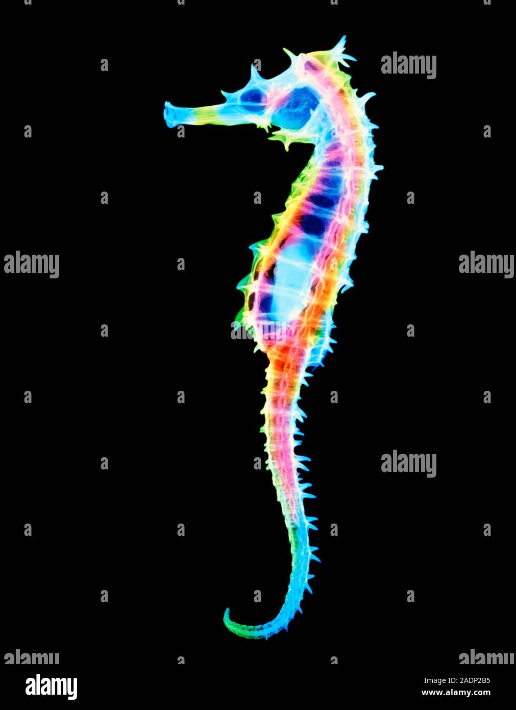 False-colour X-ray of a seahorse, Hippocampus sp., in side view. The ...