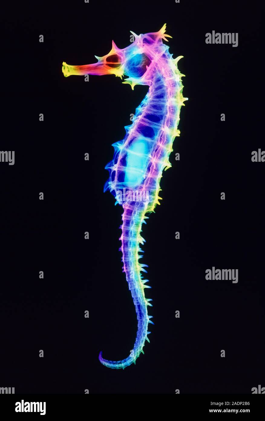 False-colour X-ray of a seahorse, Hippocampus sp., in side view. The ...