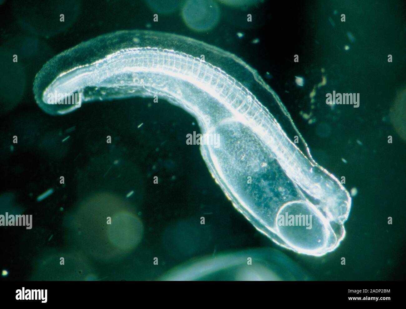 Eel embryo. Light micrograph of a newly-hatched embryo of the Japanese ...