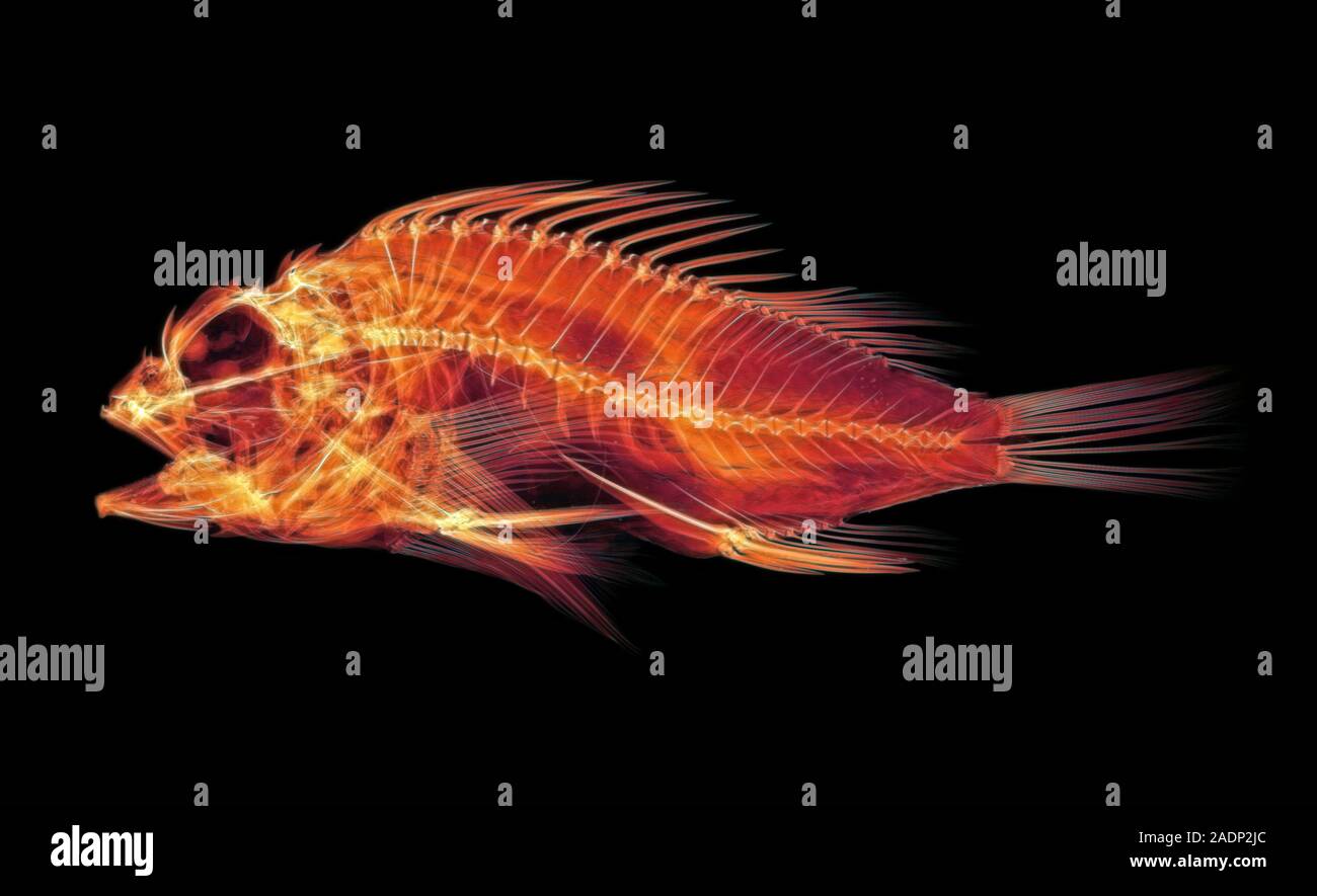 Fish, coloured X-ray. This is a type of scorpionfish (order ...