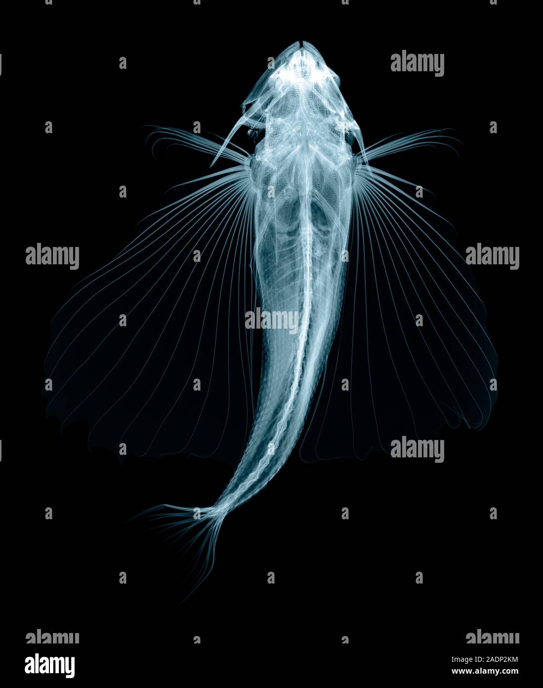 Flying fish, X-ray. Flying fish (family Exocoetidae) are named for ...