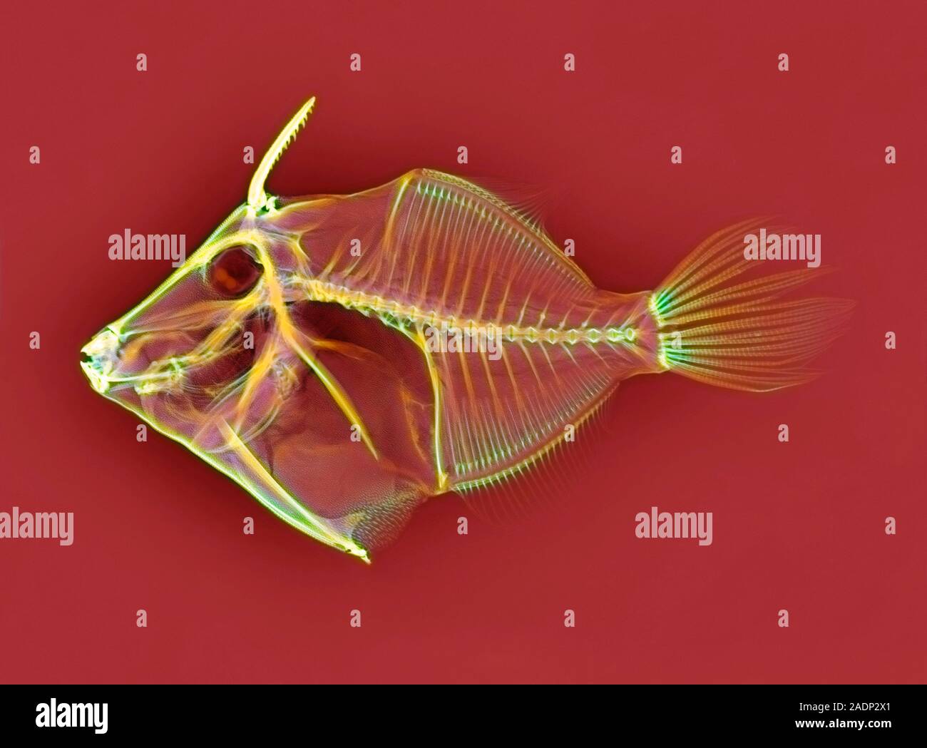 Triggerfish skeleton. Coloured X-ray of a triggerfish (family ...