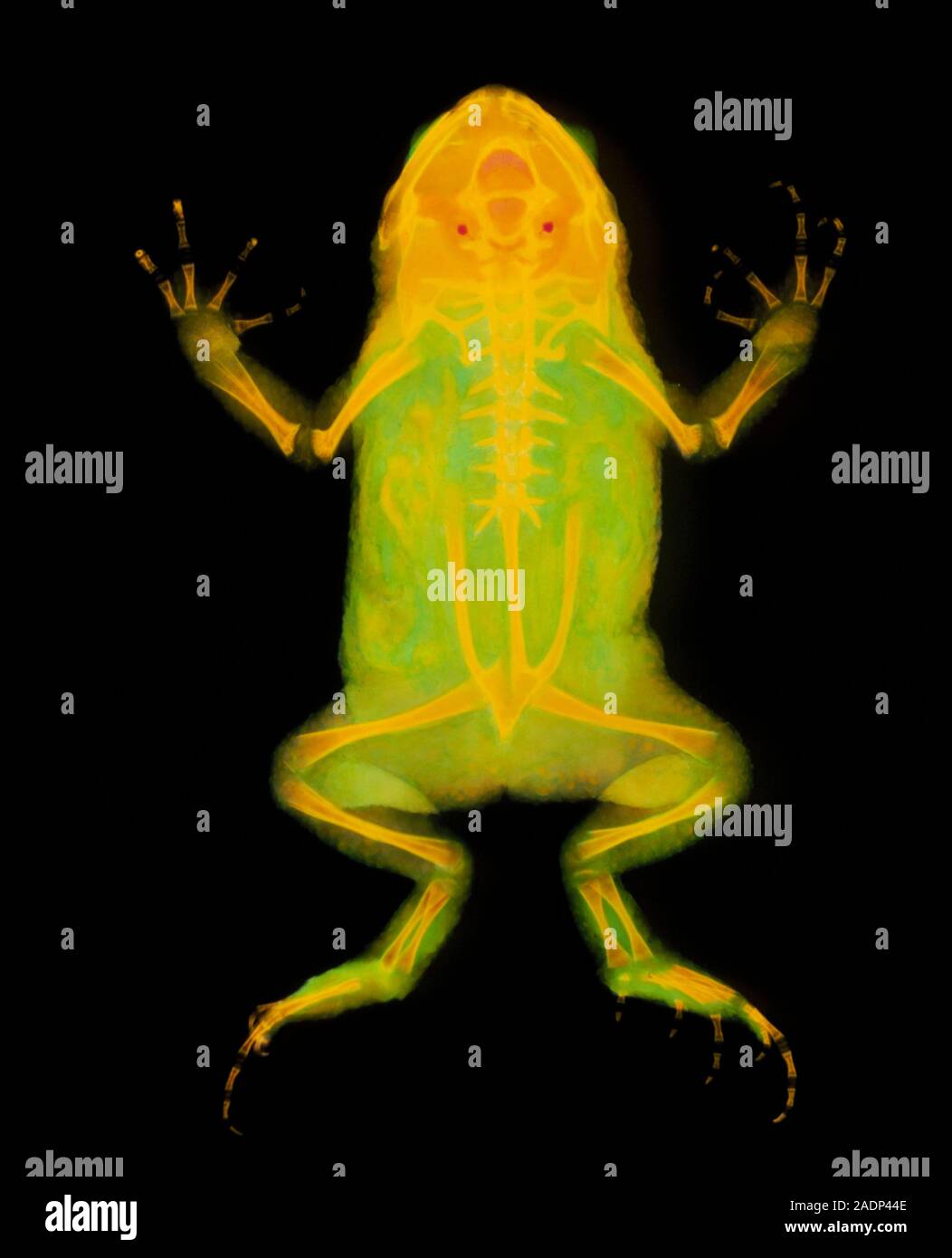 Toad. Coloured X-ray of a ventral view of a young toad, Bufo sp. Bones ...