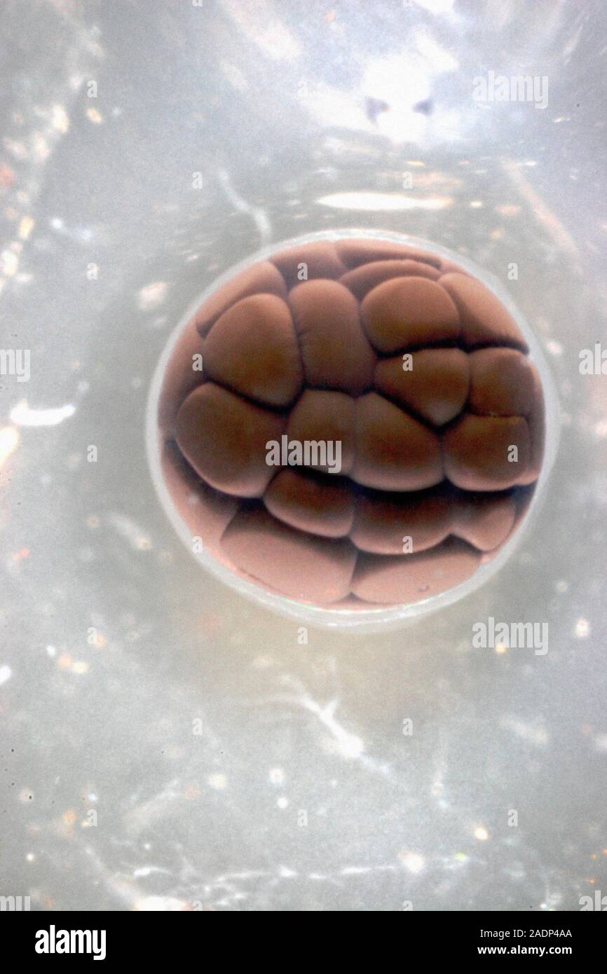 Cleavage in frog egg, light micrograph The division of cells in an ...