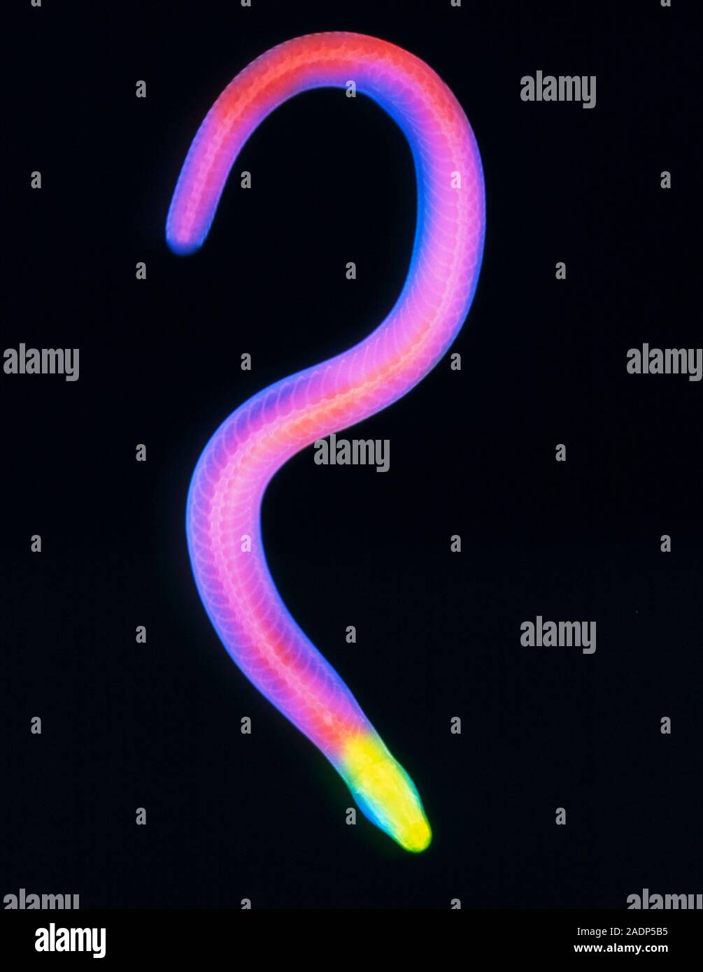 Slow-worm. Coloured X-ray of the slow-worm lizard, Anguis fragilis. The ...