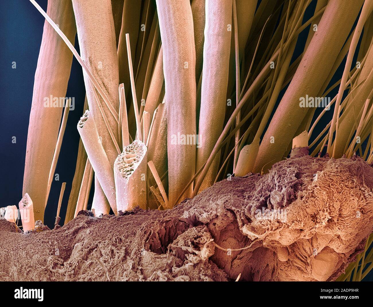 Hedgehog spines. Coloured scanning electron micrograph (SEM) of ...
