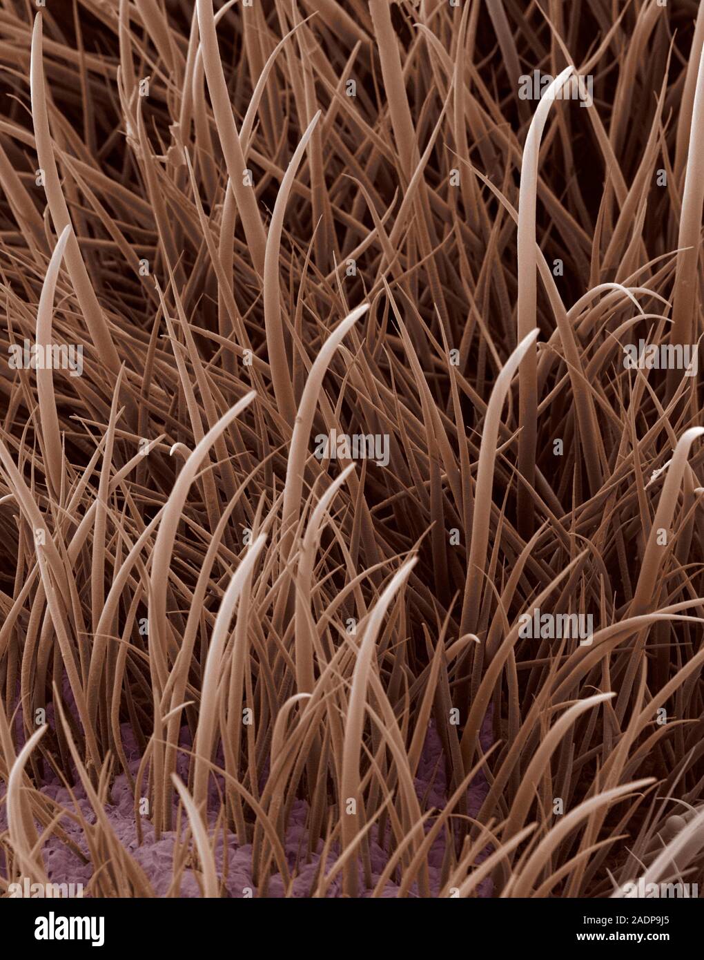 Mole hair. Coloured scanning electron micrograph (SEM) of a skin of a ...