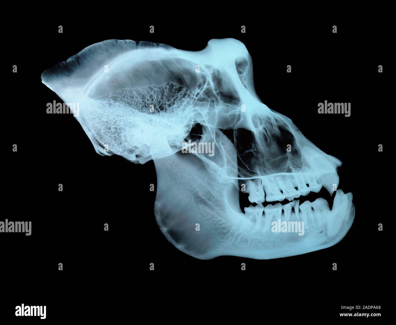 Gorilla skull (Gorilla). Side view X-ray showing the cranium, eye ...