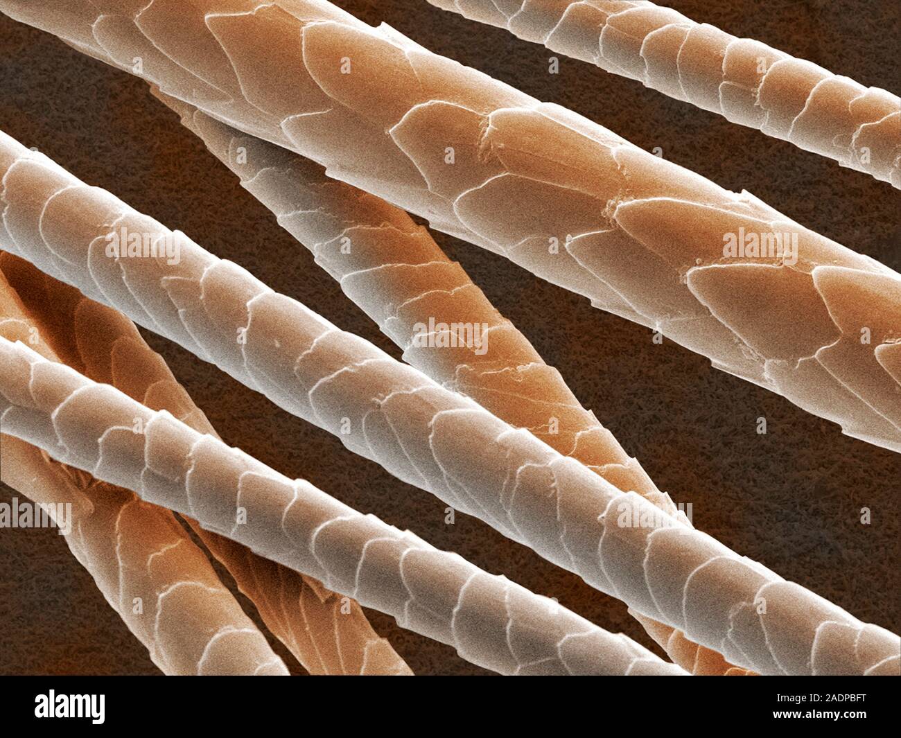 Red fox hair. Coloured scanning electron micrograph of the hairs from a ...