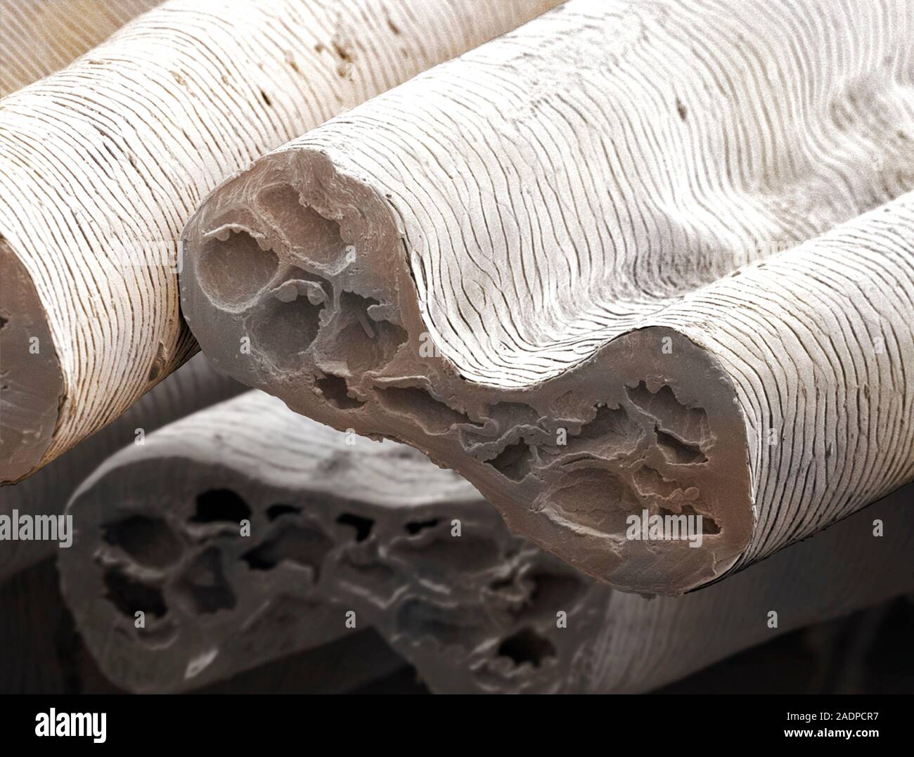 Rabbit hair. Coloured scanning electron micrograph (SEM) of the ...