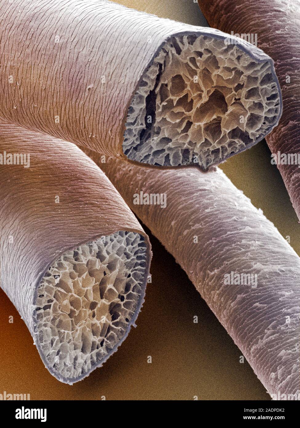 Red deer hair. Coloured scanning electron micrograph (SEM) of a cross ...