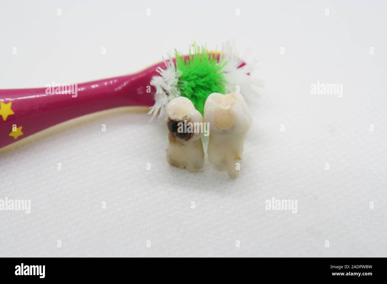 Bad tooth and toothbrush. Dental hygiene. Rotten tooth and toothbrush ...