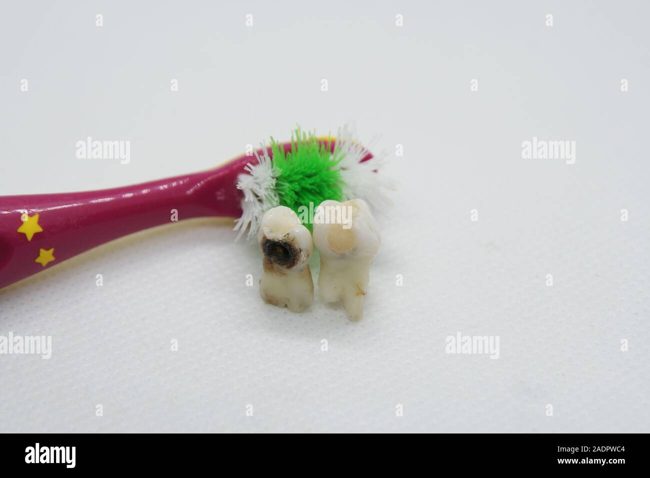 Bad tooth and toothbrush. Dental hygiene. Rotten tooth and toothbrush ...