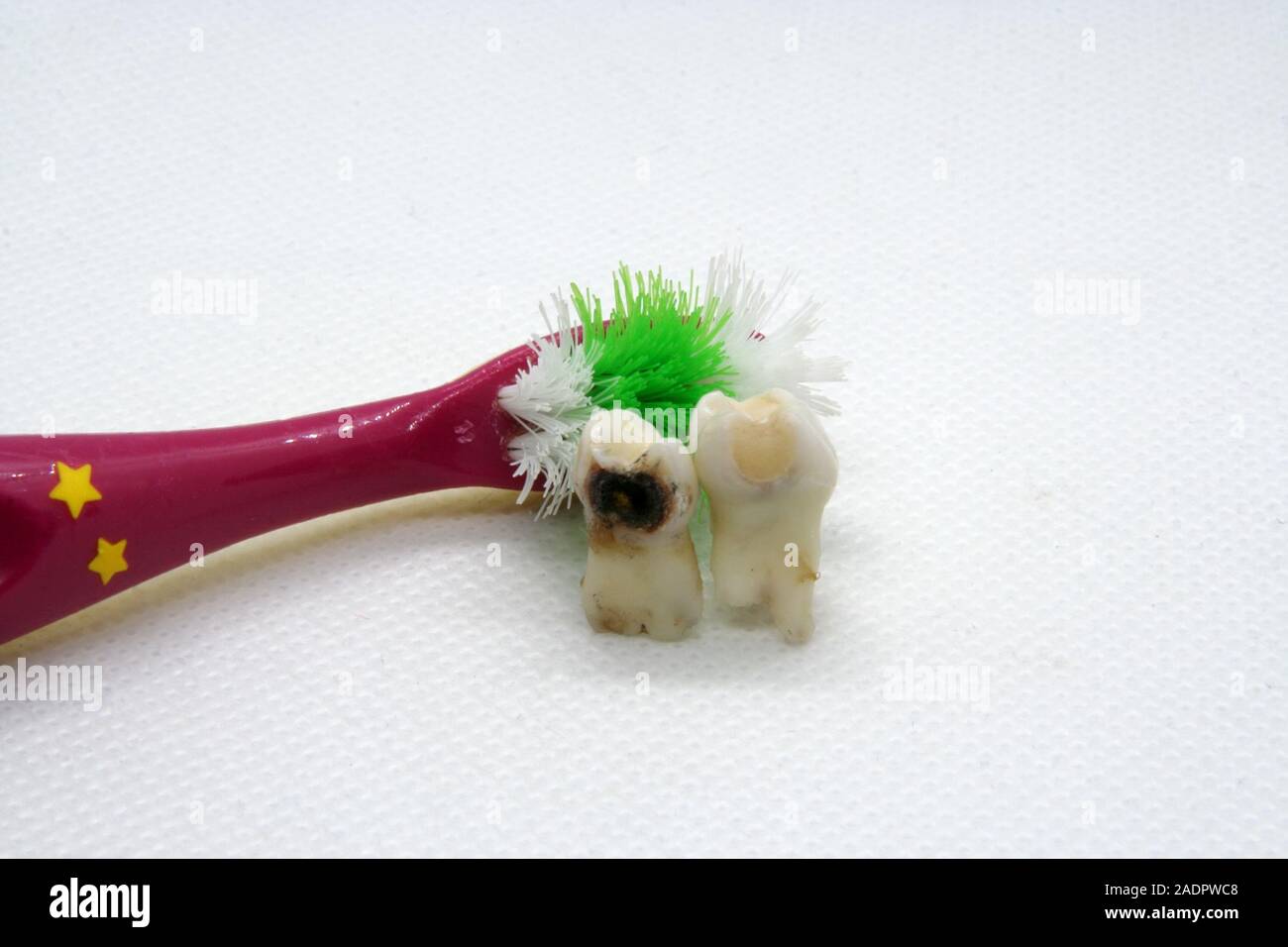 Bad tooth and toothbrush. Dental hygiene. Rotten tooth and toothbrush ...