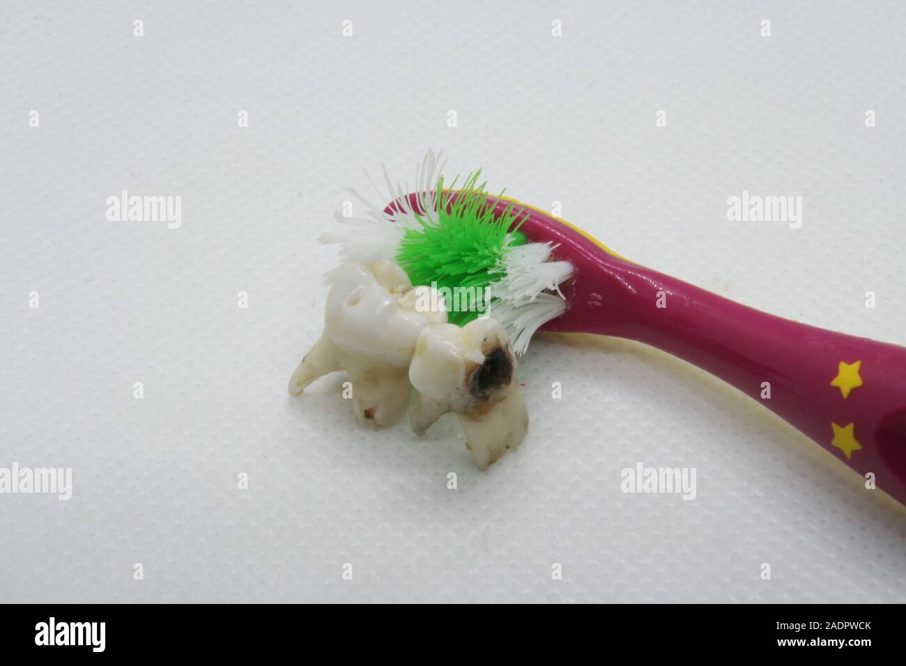 Bad tooth and toothbrush. Dental hygiene. Rotten tooth and toothbrush ...