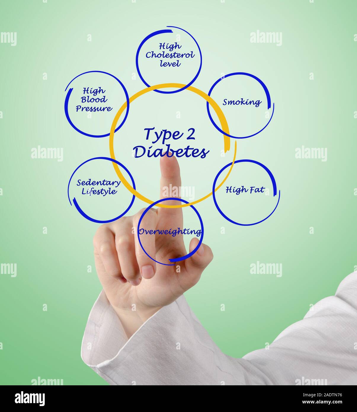Type 2 diabetes diagram hi-res stock photography and images - Alamy