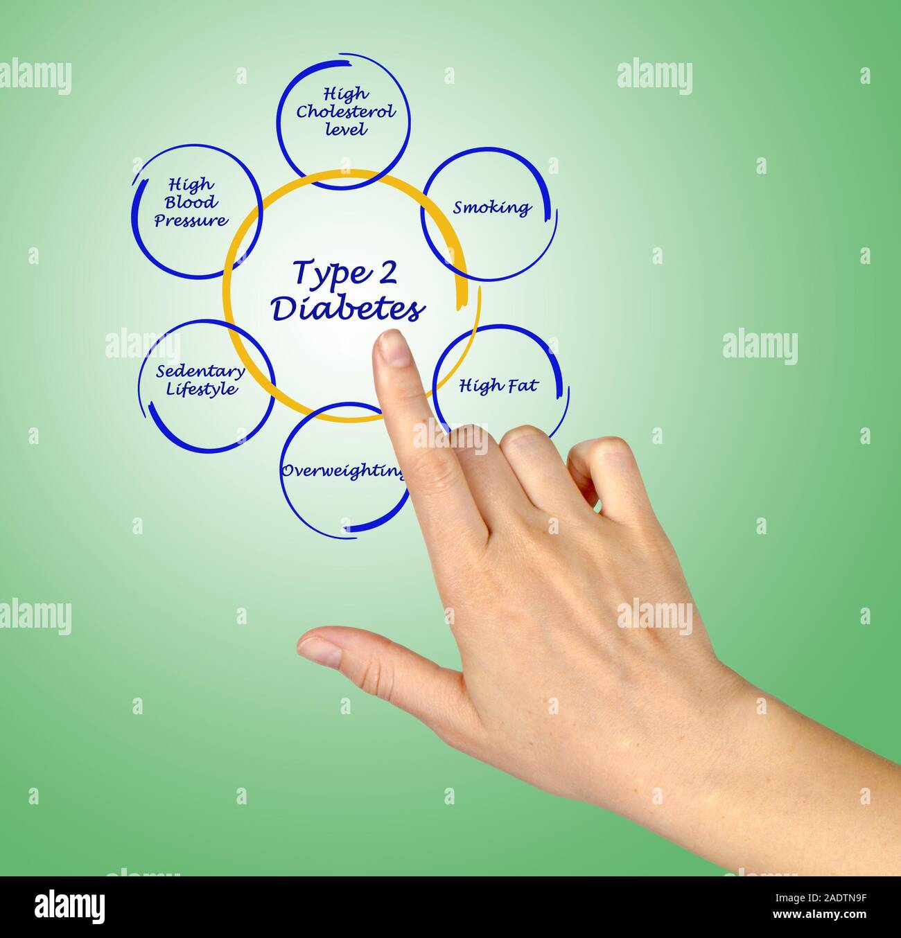 Type 2 diabetes diagram hi-res stock photography and images - Alamy