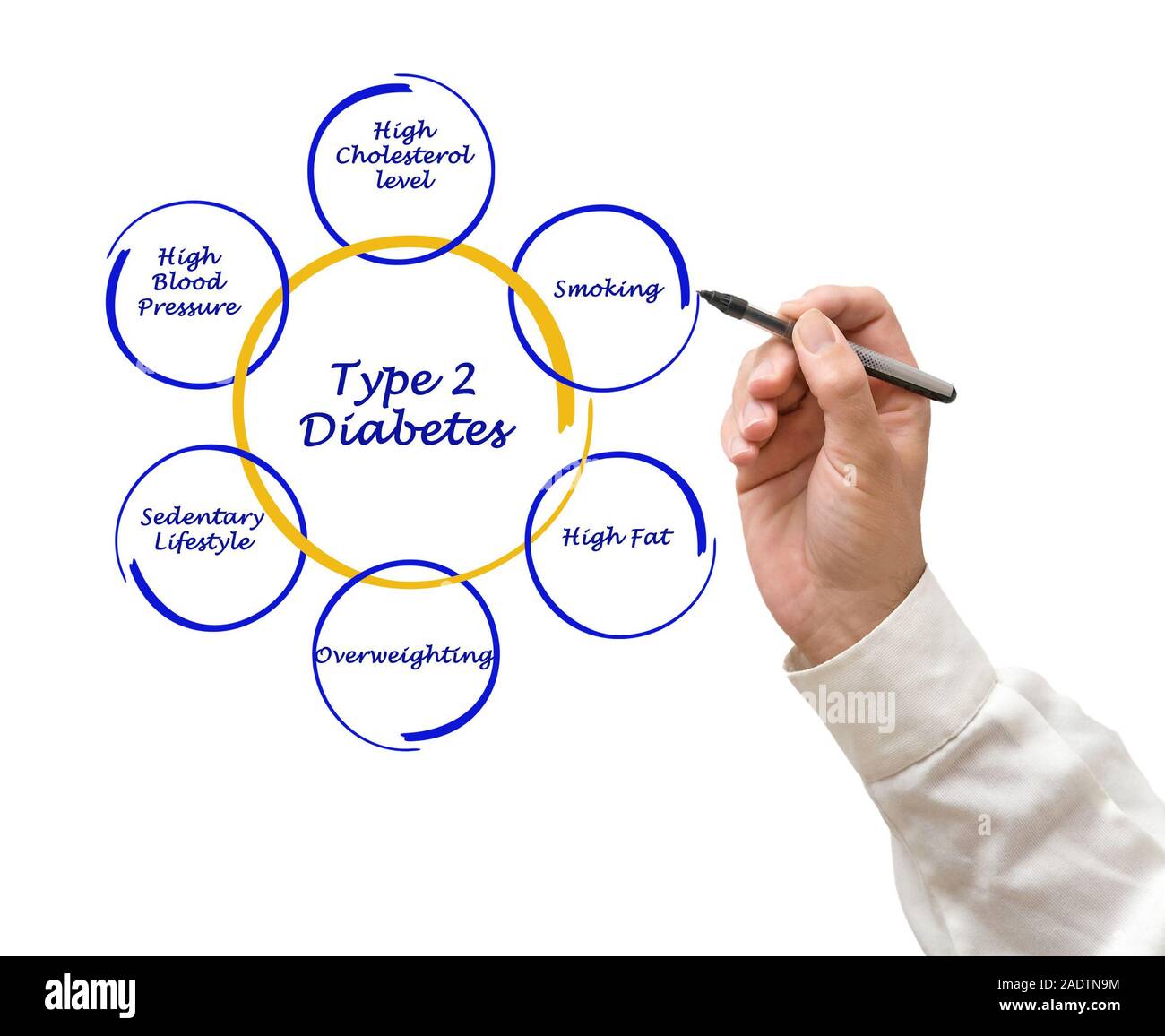 Type 2 diabetes diagram hi-res stock photography and images - Alamy